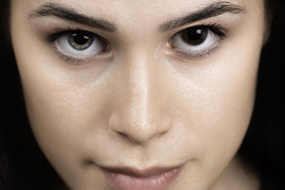 Occhi di colore diverso, perché? • Nove da Firenze